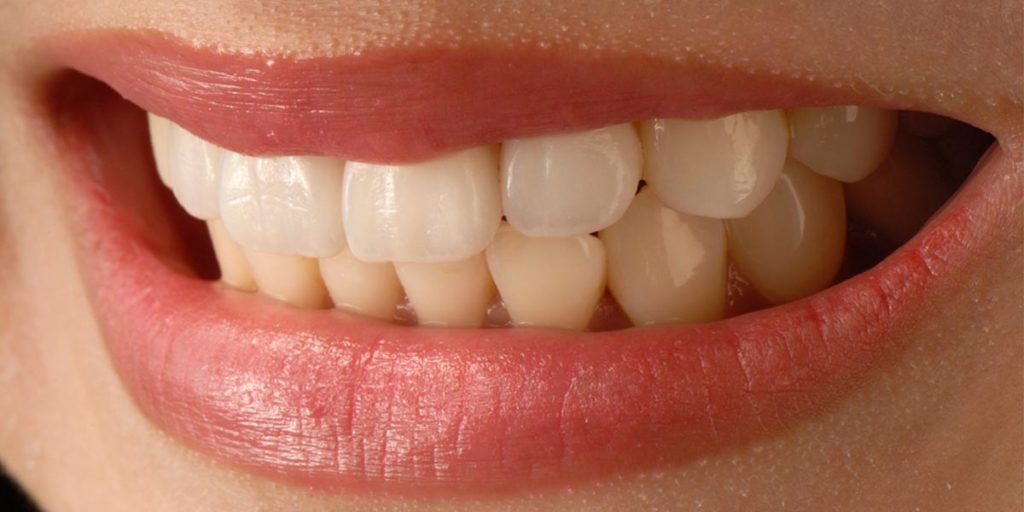 5 Tooth Sensitivity Treatment Options You Should Know - Keep 28 Dental